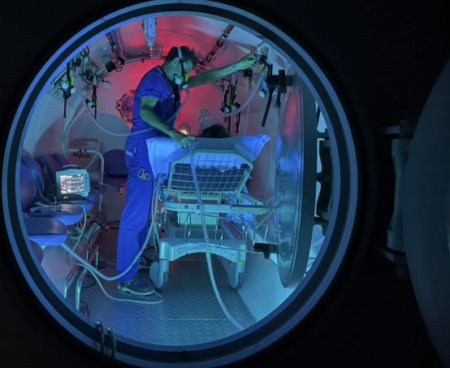 Ossigenoterapia Iperbarica nella malattia di Buerger - SIMSI